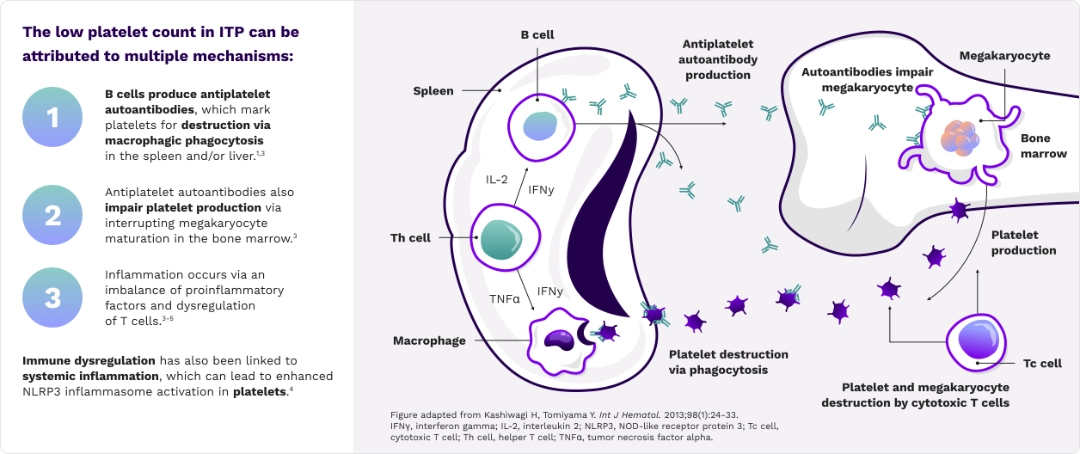 Sanofi - Therapeutic Areas -Rare blood disorders- immune thrombocytopenia
